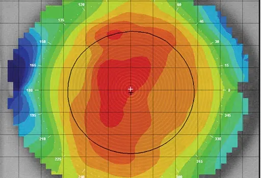 Contact Us - Mt. Baker Vision Clinic